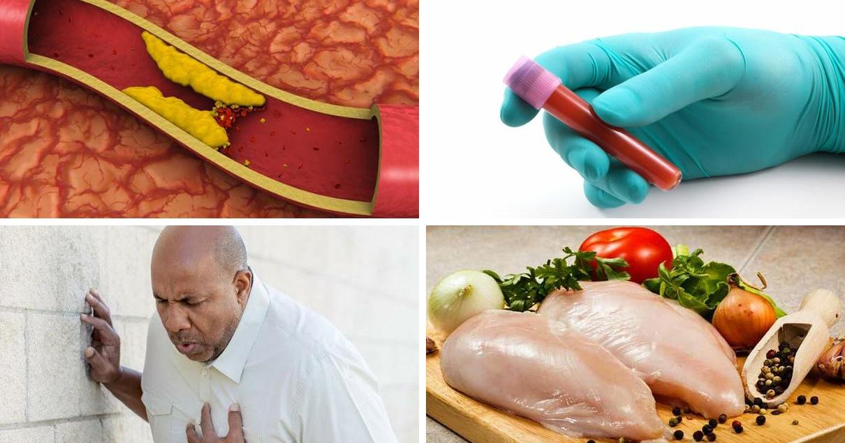 13 peligrosos síntomas que alertan de colesterol alto y dieta saludable para tratarlos | Salud