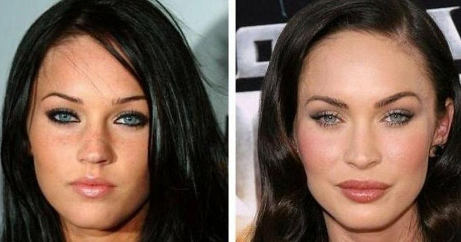 Celebrities mejor operadas: operaciones de celebridades | Belleza