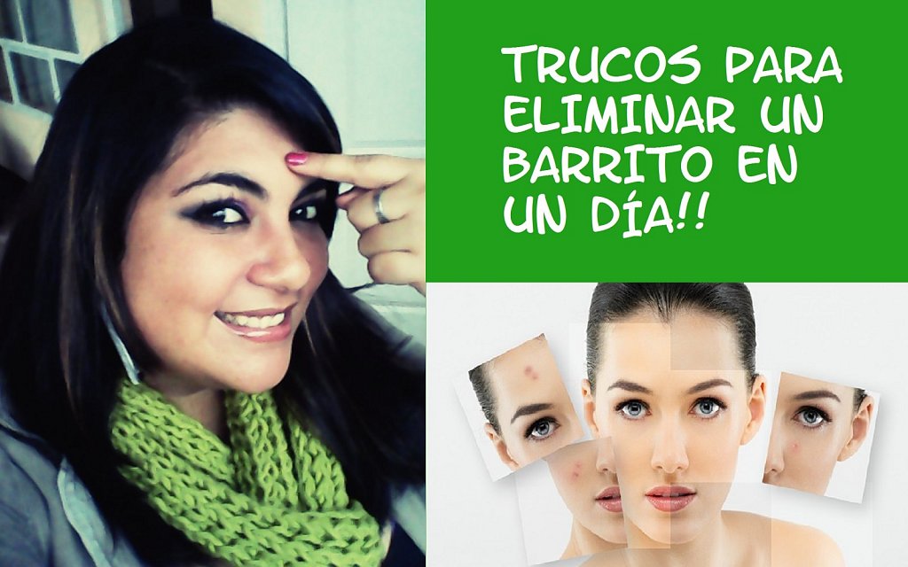 Trucos Para Eliminar Un Barrito En Un Día!! | Belleza