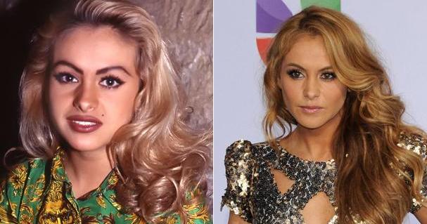 Top 7 famosas operadas, ¡te sorprenderás! | Belleza