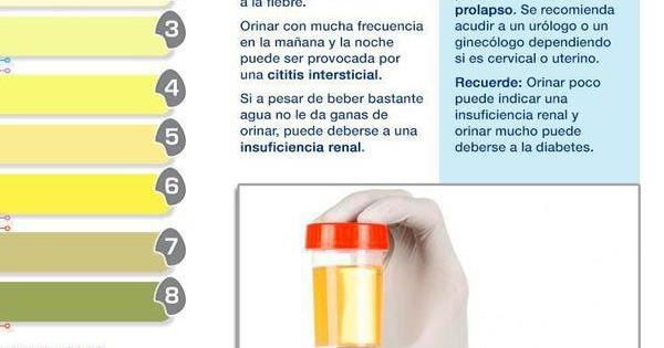 ¿De qué color es tu orina? Esto es lo que significa... | Salud