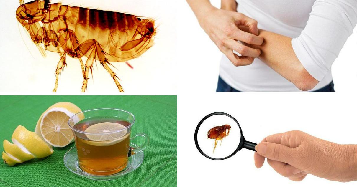 Picaduras de pulgas en personas: causas, síntomas y tratamiento | Salud