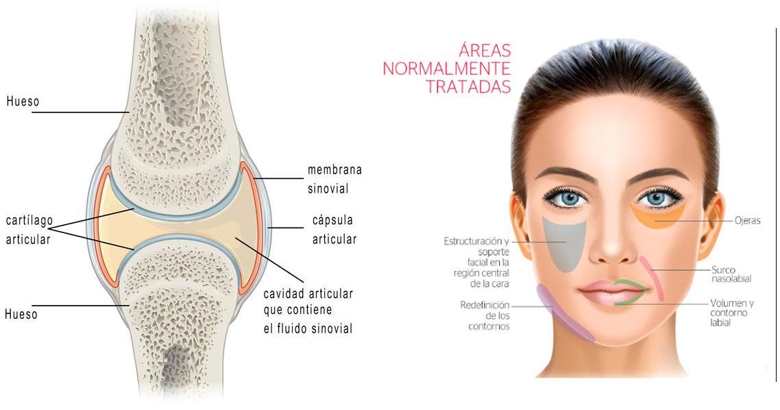 Ácido hialurónico, la molécula multifunción | Belleza