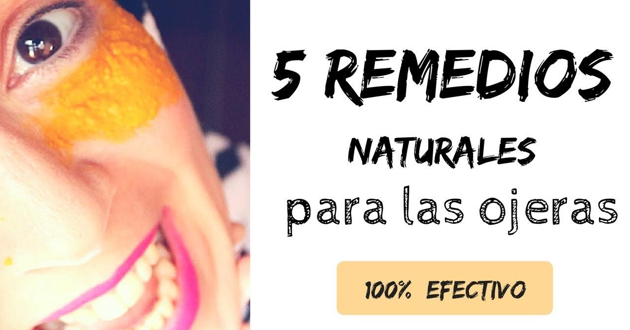 Remedios naturales para eliminar ojeras | Belleza
